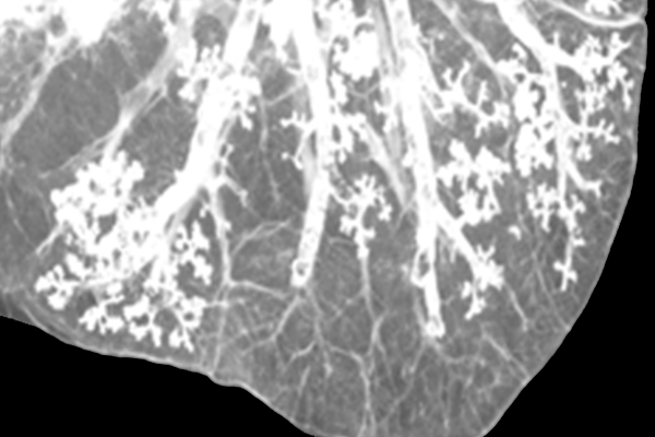 Introduction to Acute Care Imaging - MRI Online is now Medality