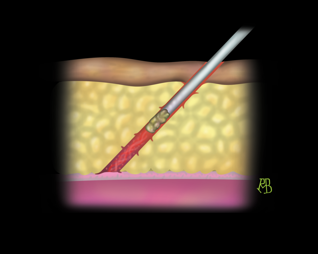 Modalities for Image Guided Biopsy - MRI Online is now Medality