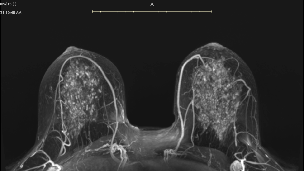 Breast MRI - Radiology Course - MRI Online is now Medality