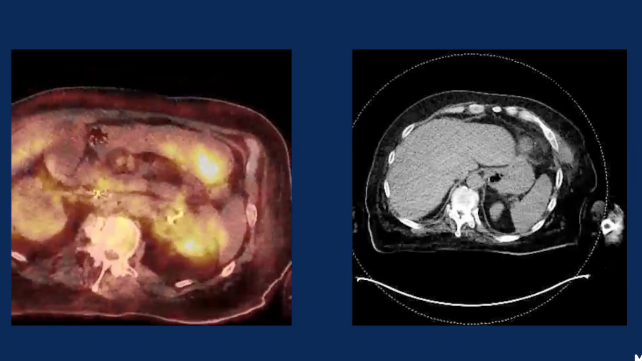 Chest Support Lines, Part 1 w/ Dr. Kitt Shaffer, 6/24/21 - MRI Online ...