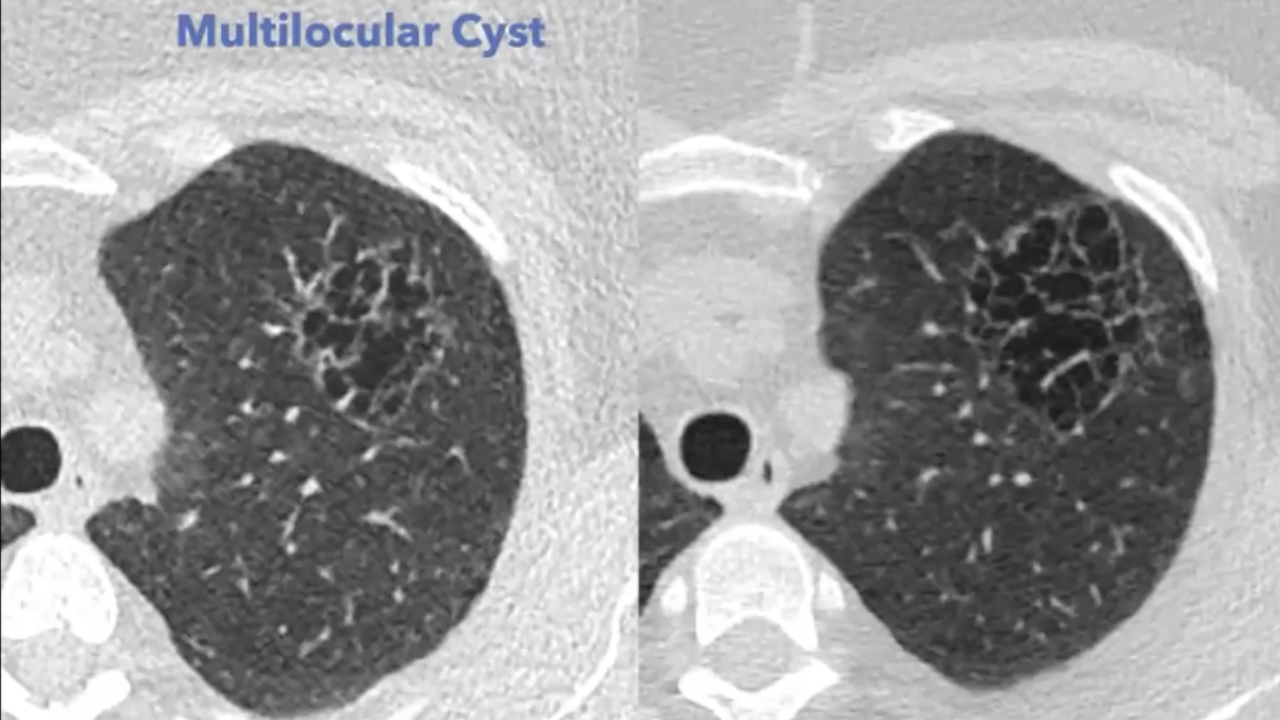 Contrast Dynamics on Chest CTA: Ancillary Physiologic Information, Dr ...