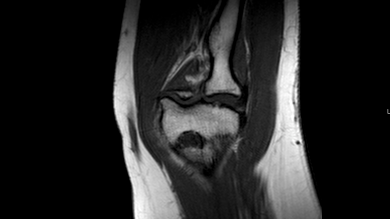 Elbow MRI Cases - Radiology Course - MRI Online is now Medality