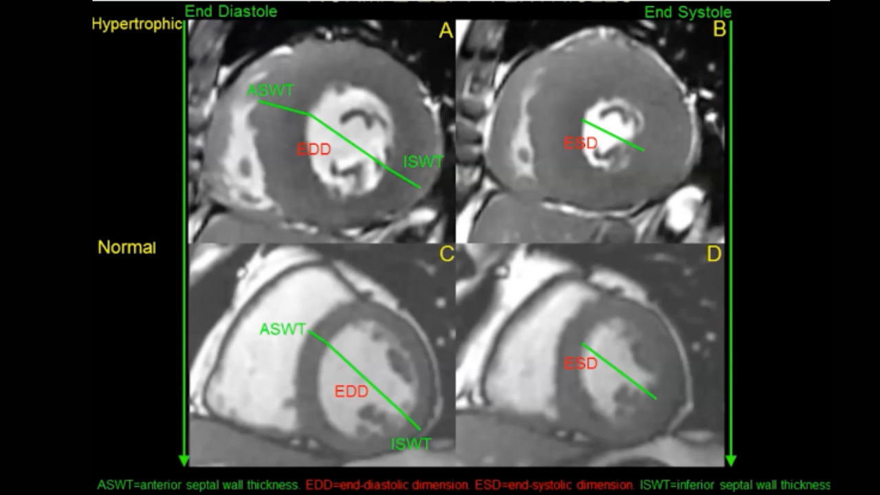Introduction to Fetal MRI, Dr. Brandon Brown (10-19-20) - MRI Online is ...