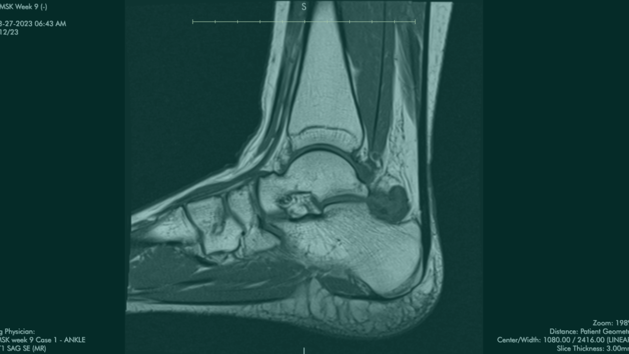 Wk 4, Case 1, Shoulder MR - Review - MRI Online is now Medality