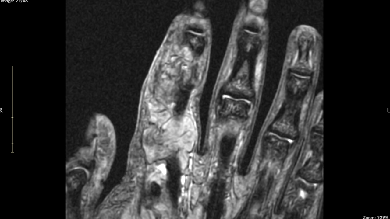 Hand MRI Cases - Radiology Course - MRI Online is now Medality