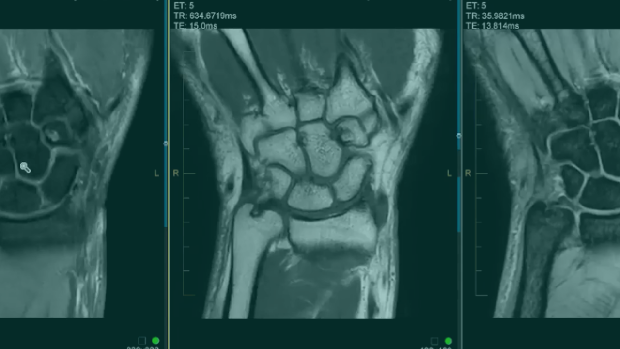 Hand and Wrist MRI - November 2024 - Radiology Course - MRI Online is ...