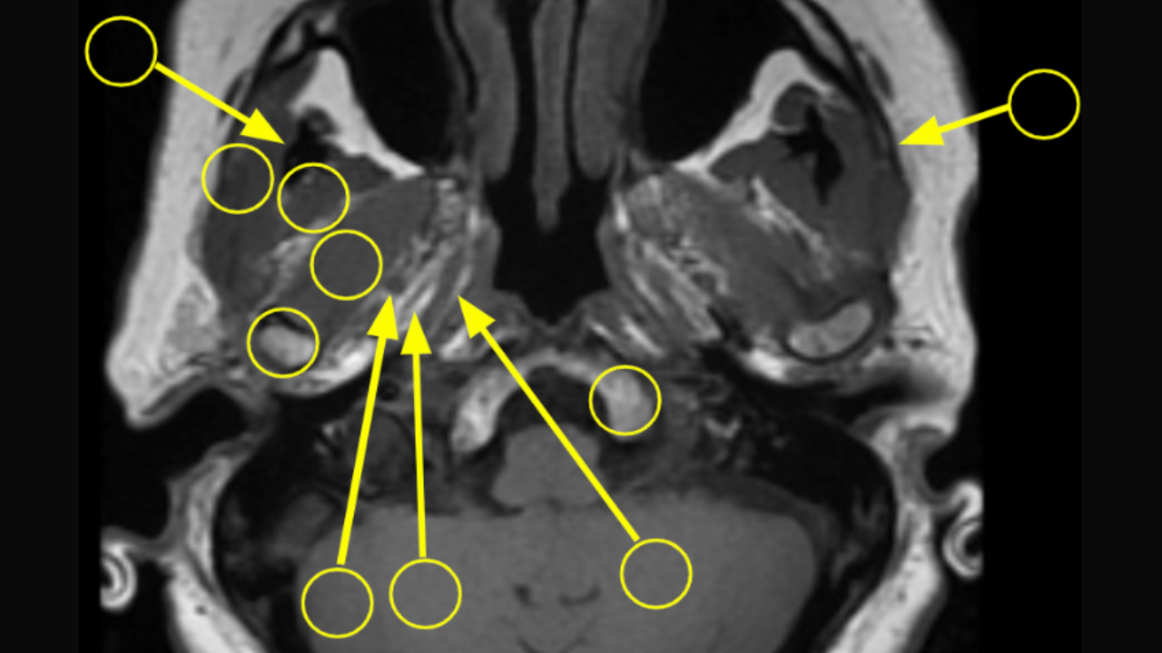Orbits Anatomy 2 - MRI Online is now Medality