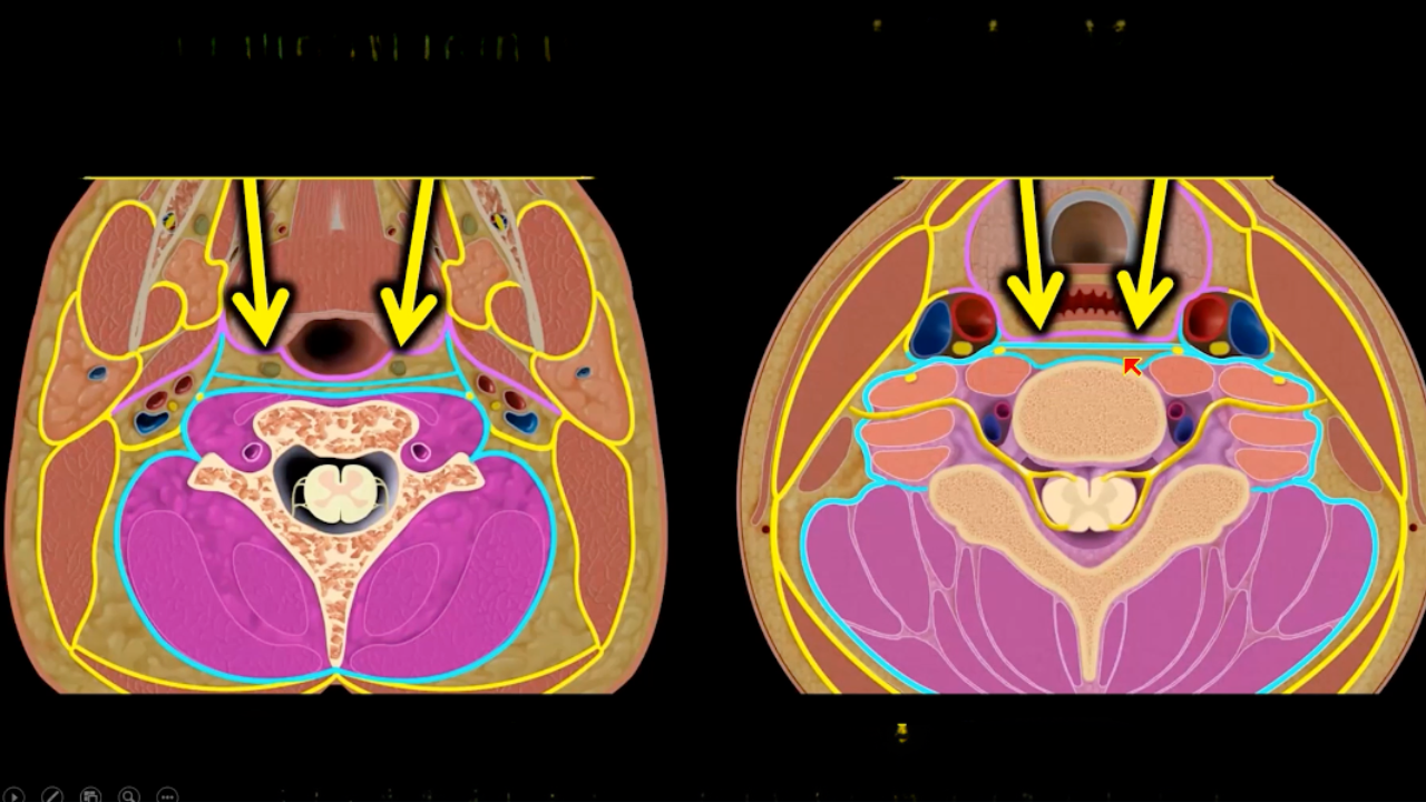 Anatomy Of Neck Spaces