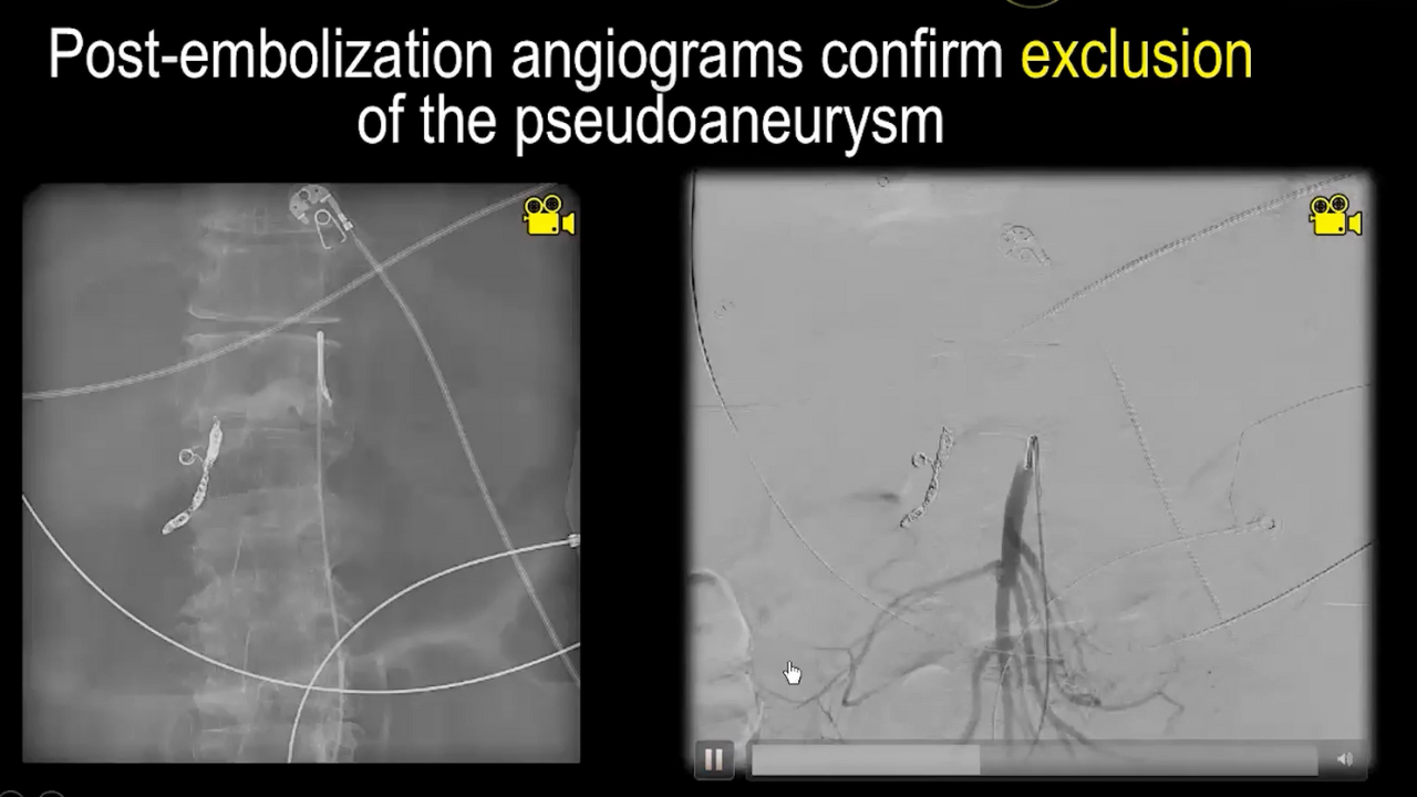 IR Case Reviews On-Demand - Radiology Course - Medality / MRI Online