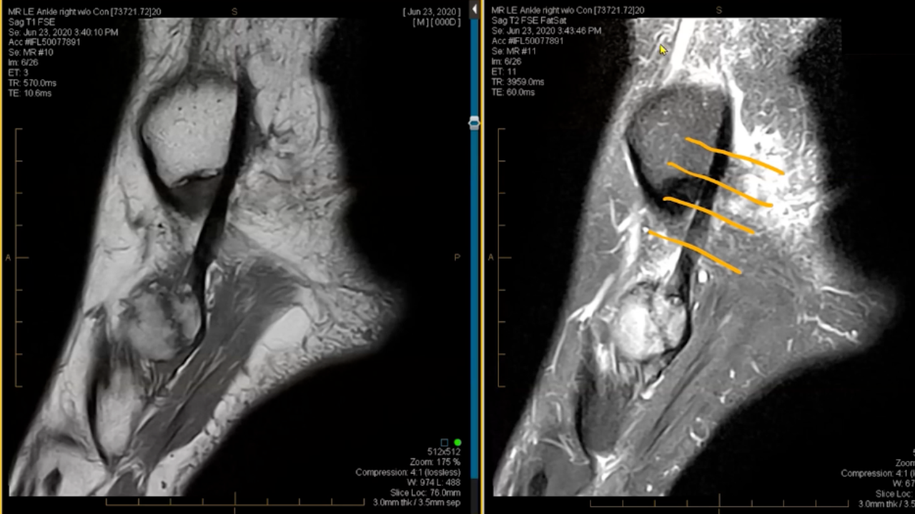 Interesting MSK MRI Cases Expert Case Review - Radiology Course - MRI ...