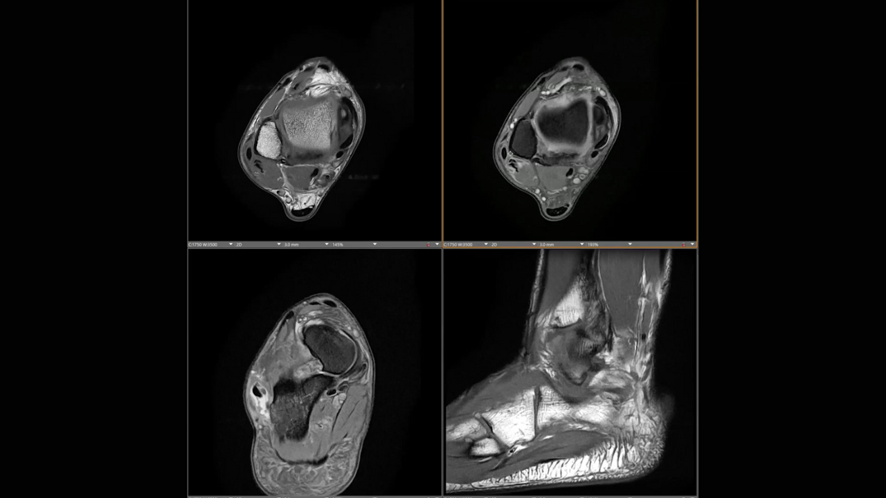 Lower Extremities: Foot & Ankle - Radiology Course - MRI Online is now ...