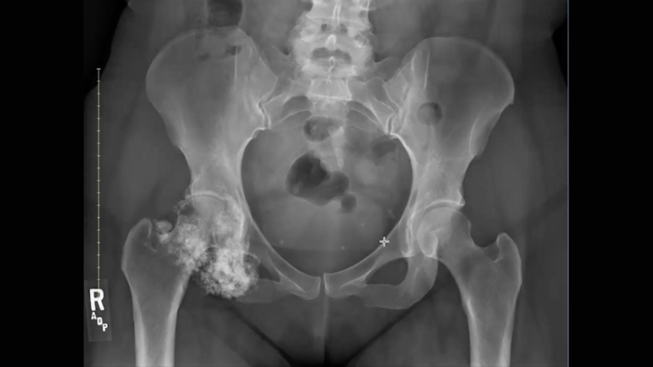 Anatomy of the Hip Joint - MRI Online is now Medality