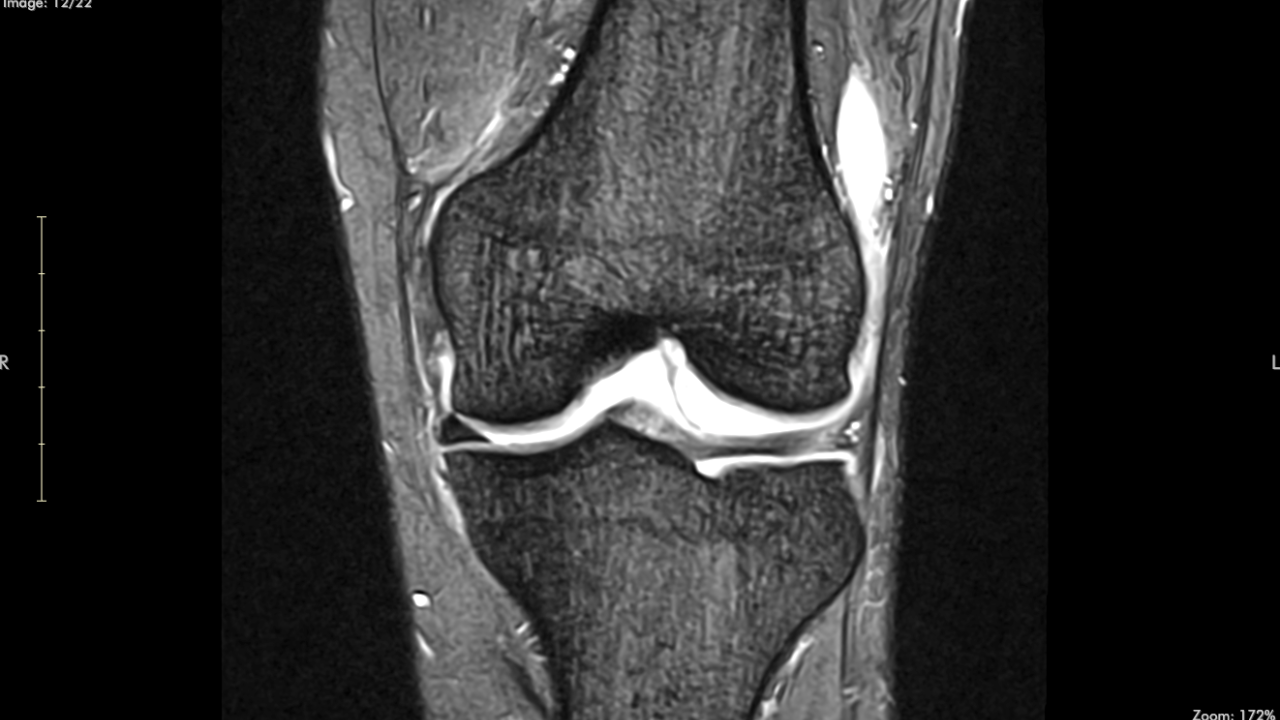 Musculoskeletal (MSK) MRI Cases - Radiology Course - MRI Online is now Medality