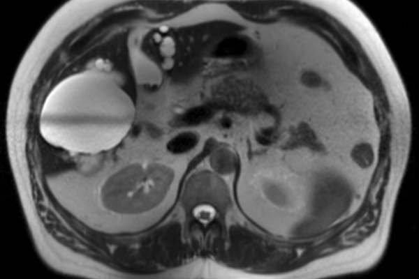 Rare Diseases Expert Case Review - Radiology Course - Medality / MRI Online