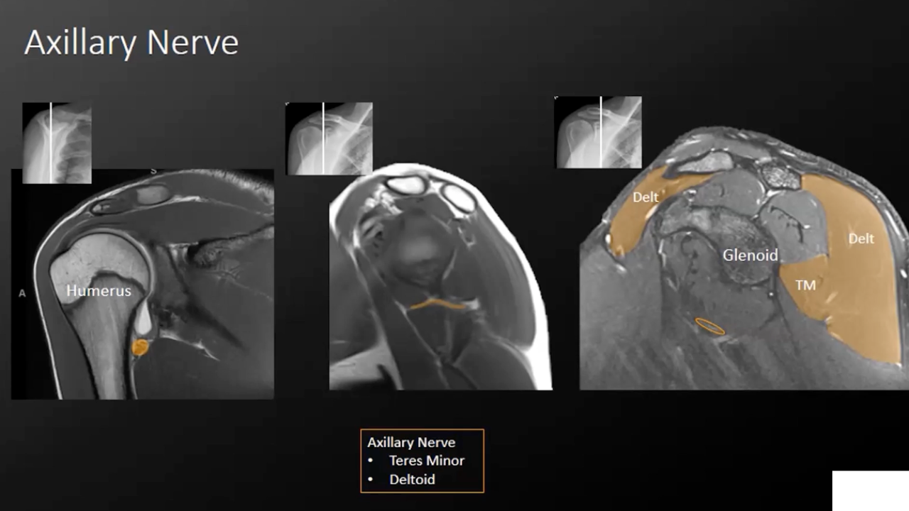 68 year old with injury from box cutter - MRI Online is now Medality