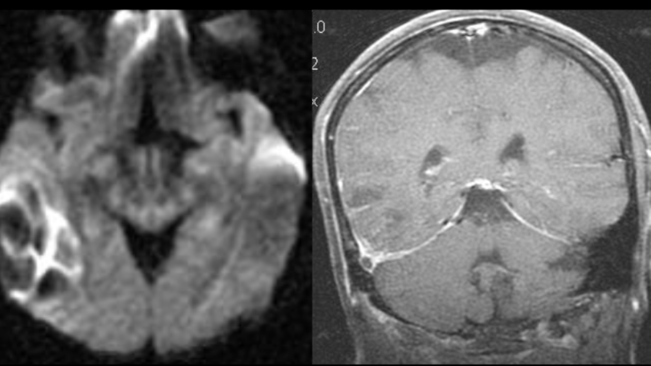 Brain Quiz Bank - Section 3 - Radiology Course - MRI Online is now Medality