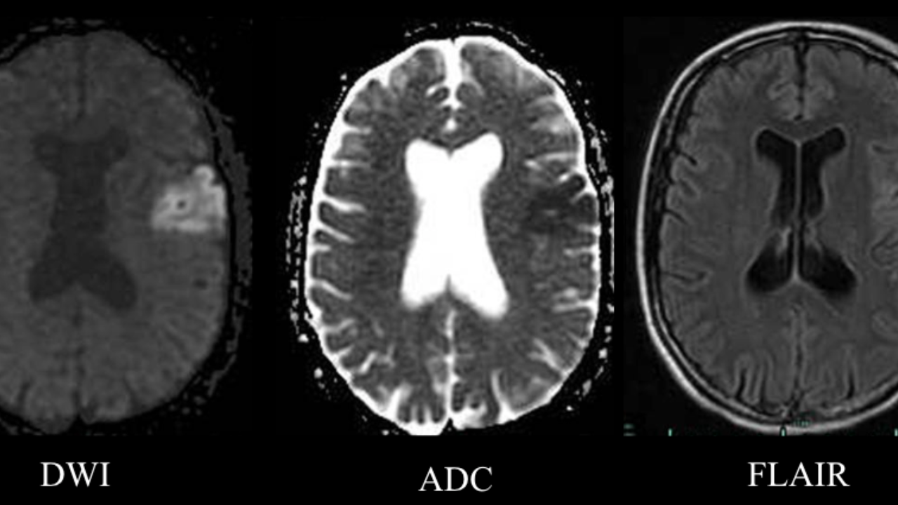 Brain Quiz Bank - Section 5 - Radiology Course - MRI Online is now Medality