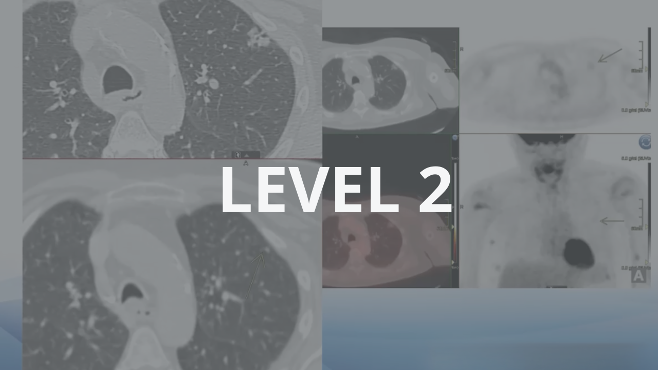 Nuclear Medicine Lectures - Level 2 - Radiology Course - MRI Online is ...