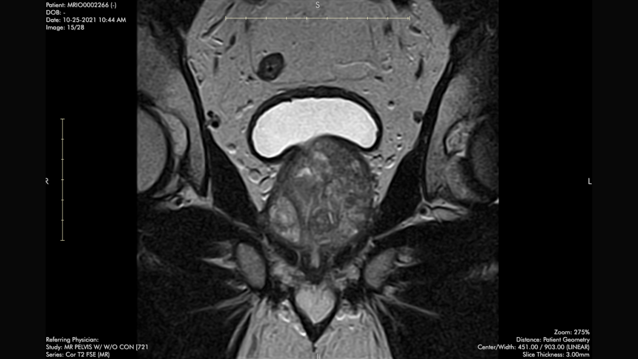 Prostate MRI Cases - Radiology Course - MRI Online is now Medality