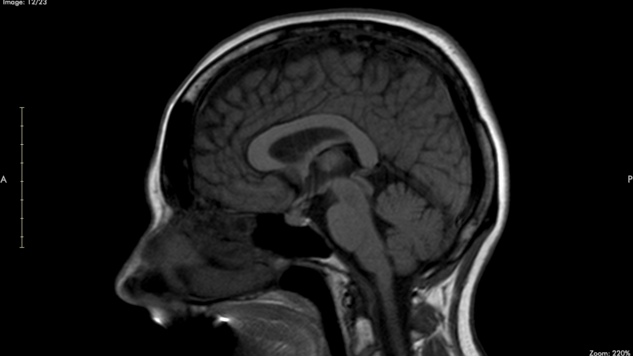 Sella MRI Cases - Radiology Course - Medality / MRI Online