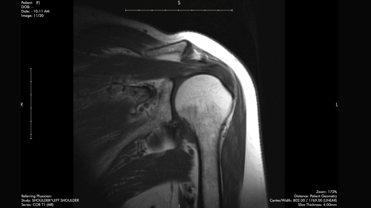 Case 3 - 53-year-old male patient presents with pain and catching of ...