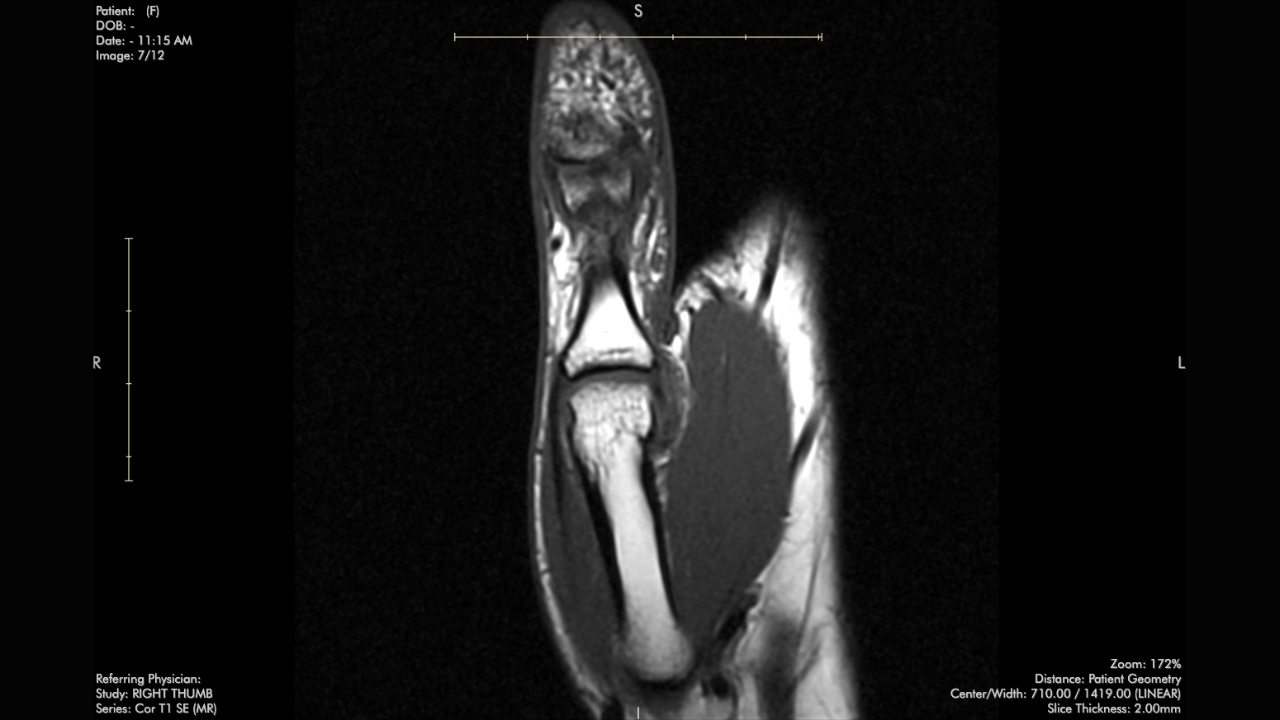 Thumb & Finger MRI Cases - Radiology Course - MRI Online is now Medality