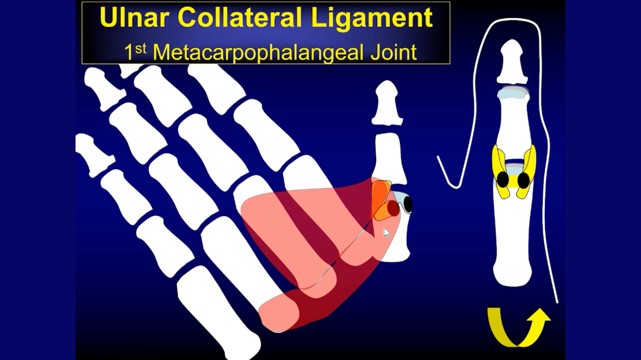 Upper Extremities: Finger - Radiology Course - MRI Online is now Medality