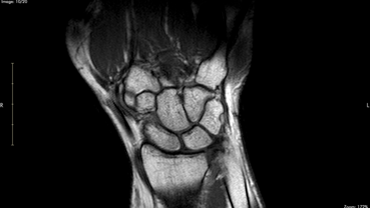 Wrist MRI Cases - Radiology Course - MRI Online is now Medality