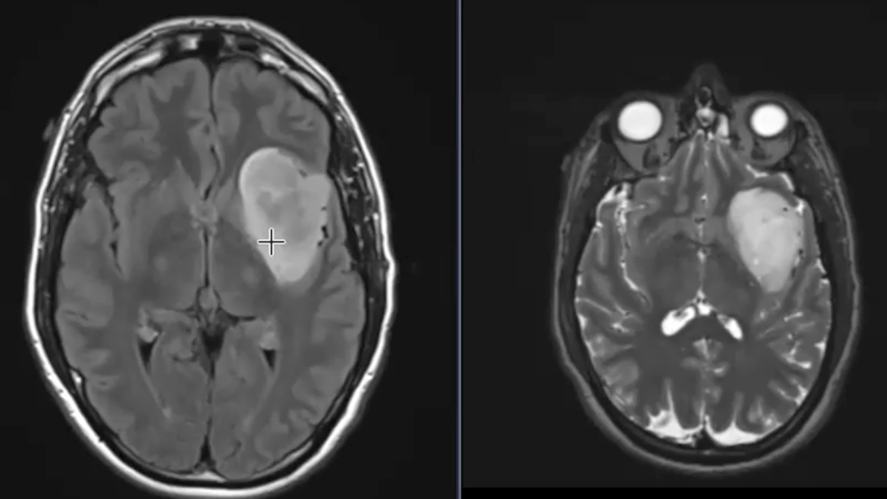 Case: Assessing Lesion Position - MRI Online is now Medality