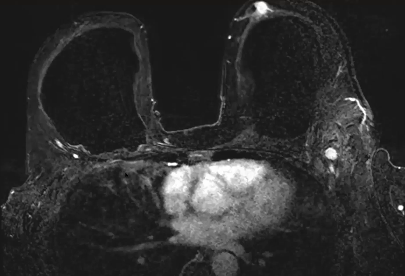 Diagnostic Workup - Key Take Home Points - MRI Online is now Medality