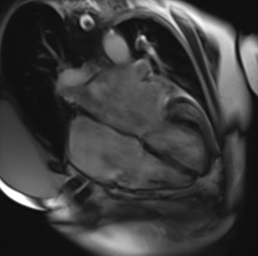 Cardiac MRI Case 1 - MRI Online is now Medality