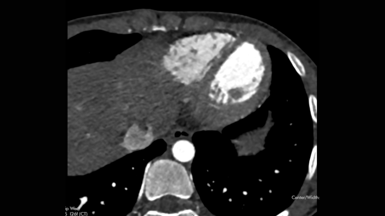 Cardiac CT Lectures and Supplemental Materials - Radiology Course - MRI ...