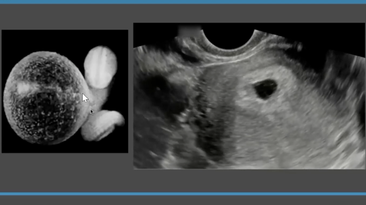 First Trimester Framework - Medality / MRI Online