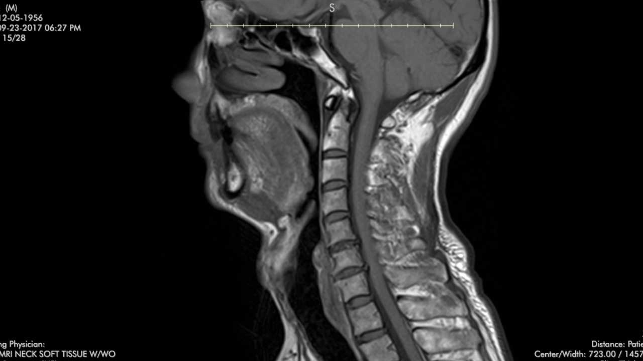 Head and Neck Neuroradiology - Radiology Course - MRI Online is now ...