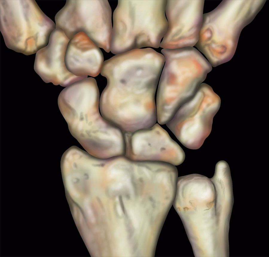 Axial Anatomy: Extensor Tendons - Medality / MRI Online