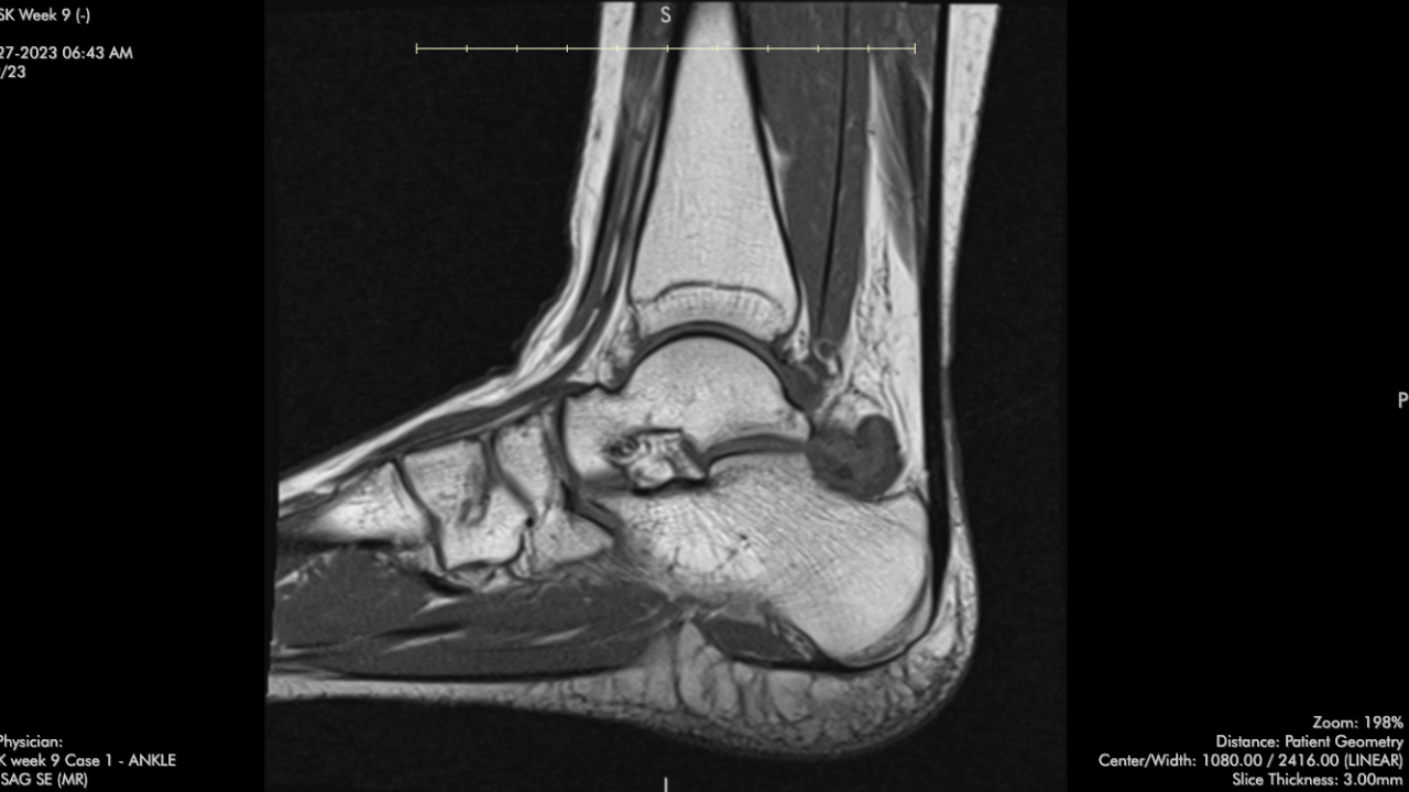 MSK MRI Practice Cases - Radiology Course - MRI Online is now Medality