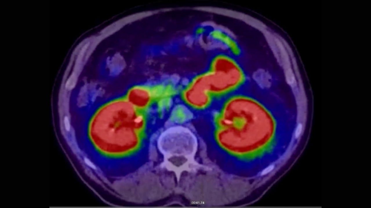 Scan Parameters and Protocols - MRI Online is now Medality