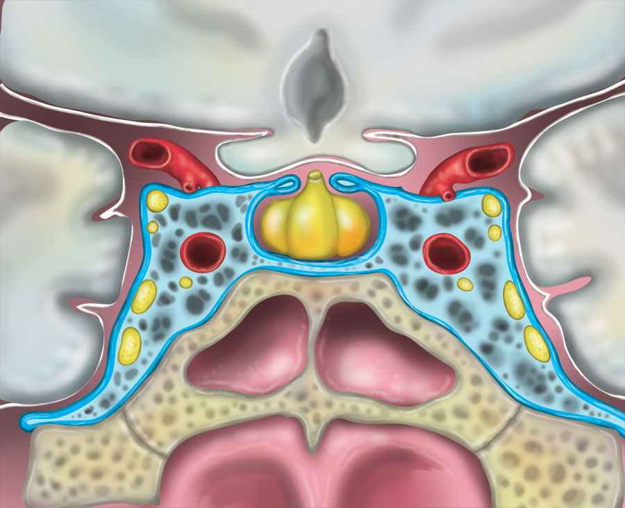 Anatomy, Traumatic Injury & Skull Base - MRI Online is now Medality