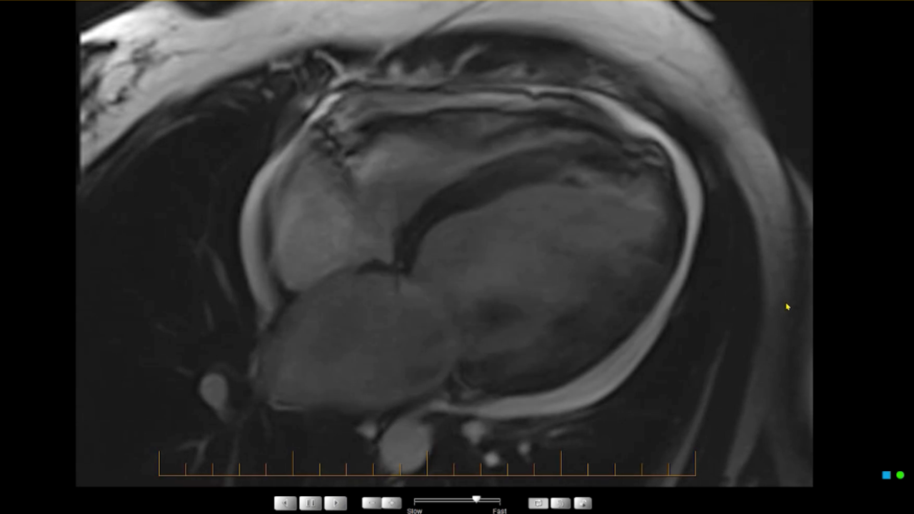 Cardiac MRI Fellowship Certificate - MRI Online is now Medality