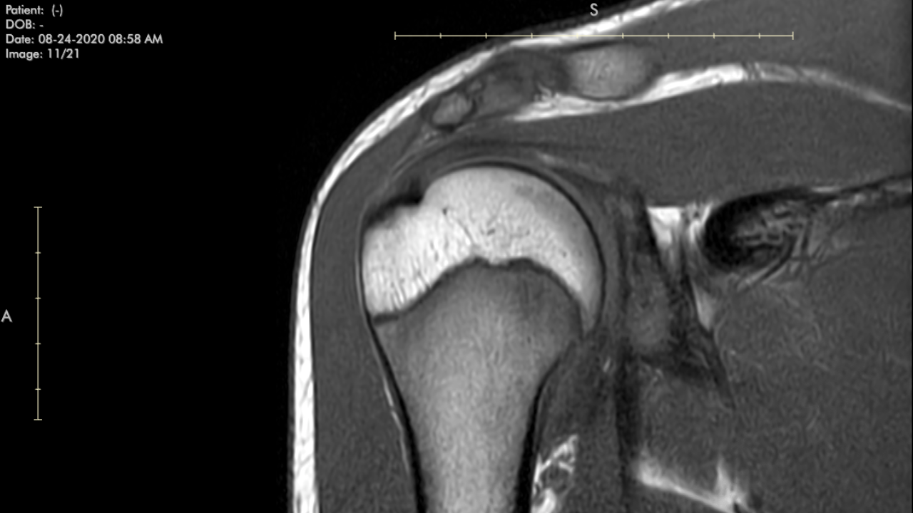 Shoulder MRI Fellowship Certificate - MRI Online is now Medality